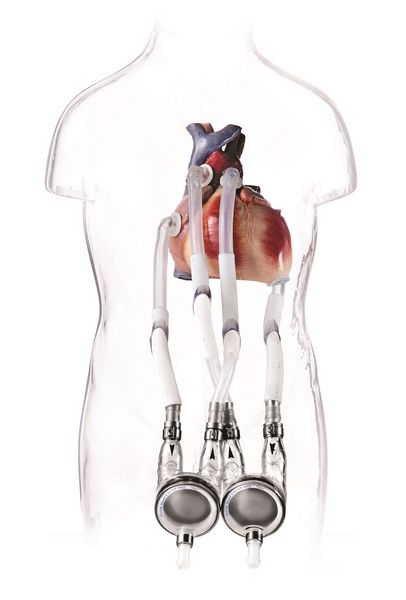 Medical Professionals EXCOR Pediatric